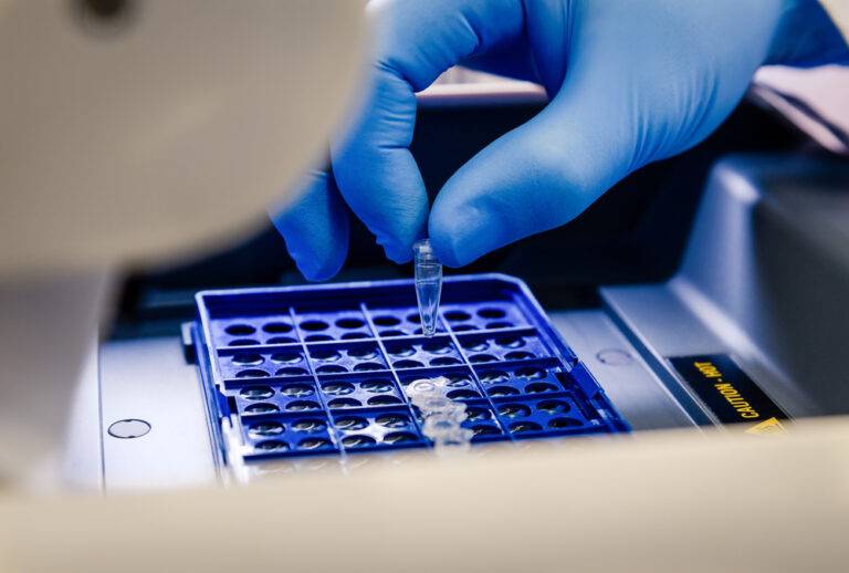 The Science of Swab Selection and Buffer Solutions